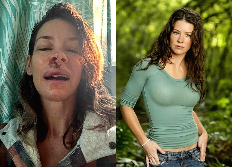 Ngất xỉu trên biển, nữ diễn viên rách mặt, chấn thương não - Sao Âu Mỹ ...