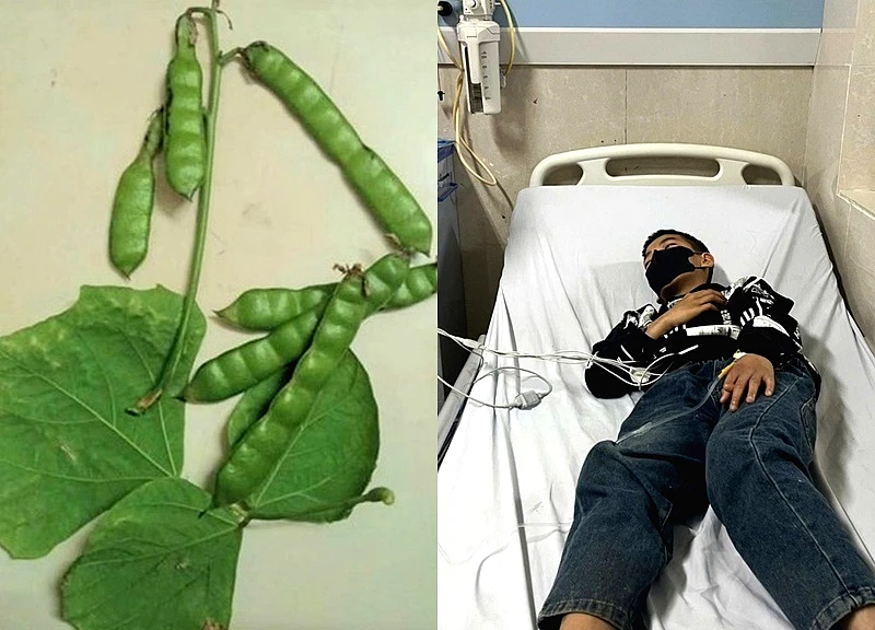 Chất độc chết người trong hạt củ đậu loại củ ngọt mát bán đầy chợ - Sức ...