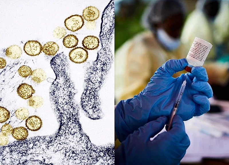 Ebola và virus Hanta phơi bày thách thức mới về y tế toàn cầu - Thế ...